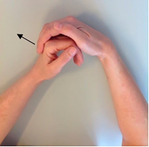 Sådan træner du efter operation for SL-ledbåndsskade i håndroden